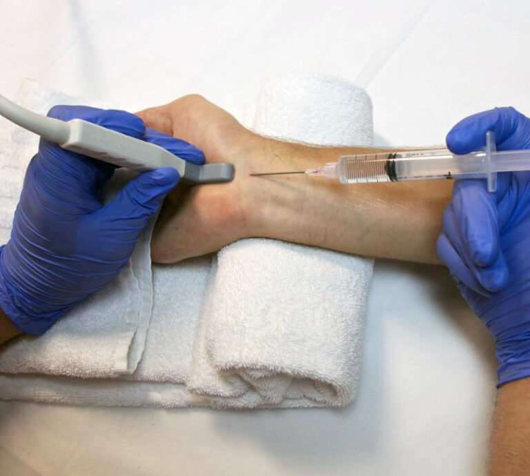 Carpal Tunnel Injections | Paragon Health Group