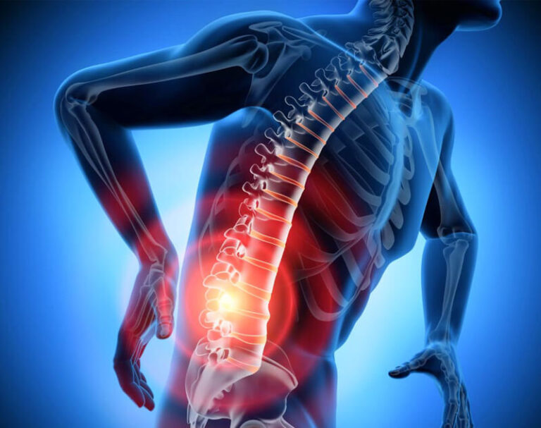 Herniated Disc Pain Relief Experts | Paragon Health Group